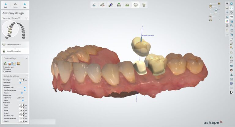 Digital Smiles | 3shape Dental System 23